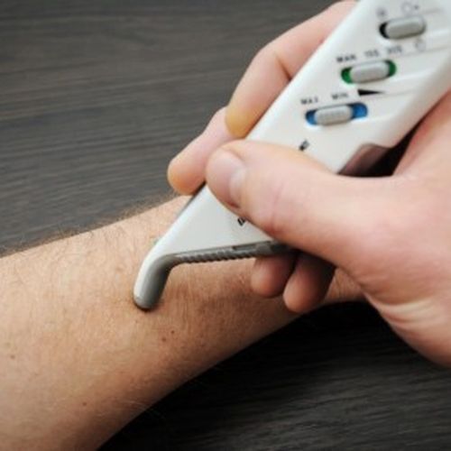 Everything you need to know about laser acupuncture ...