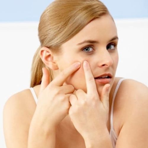 Should I Squeeze My Spots? | What Are the Consequences of Squeezing ...
