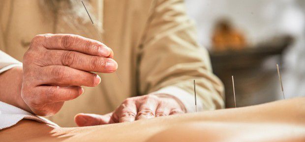Things beginners should know about Acupuncture | NaturalTherapyPages.com.au